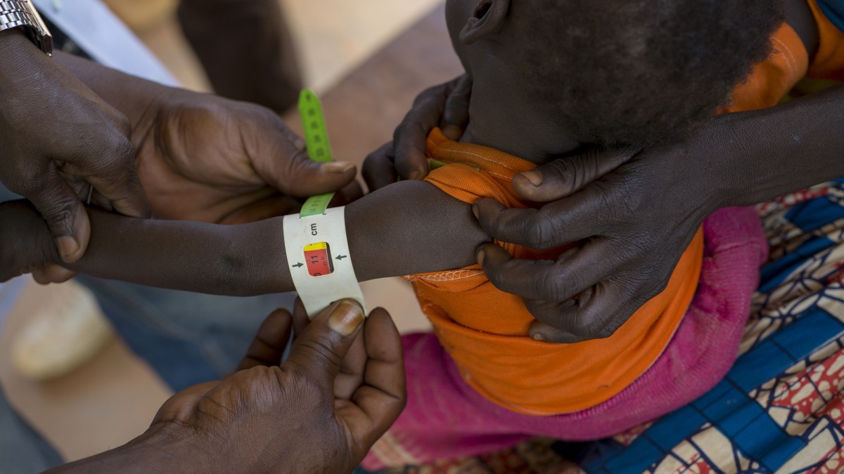 What’s the difference between malnutrition and undernutrition, and why ...