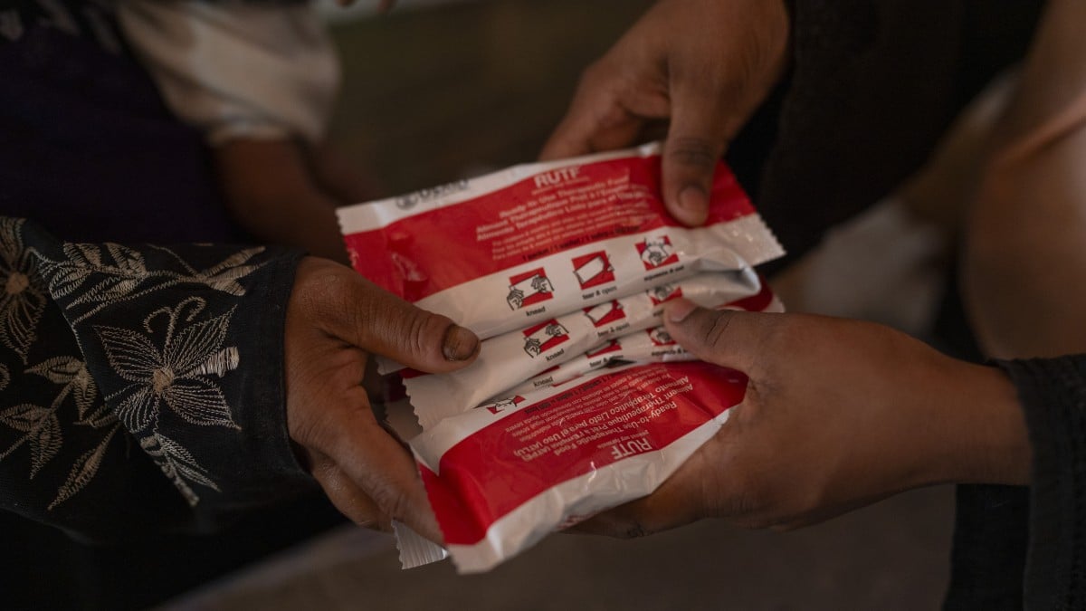 What is RUTF and why is it so important? | Concern Worldwide